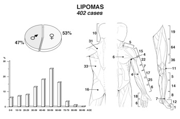 Lipoma